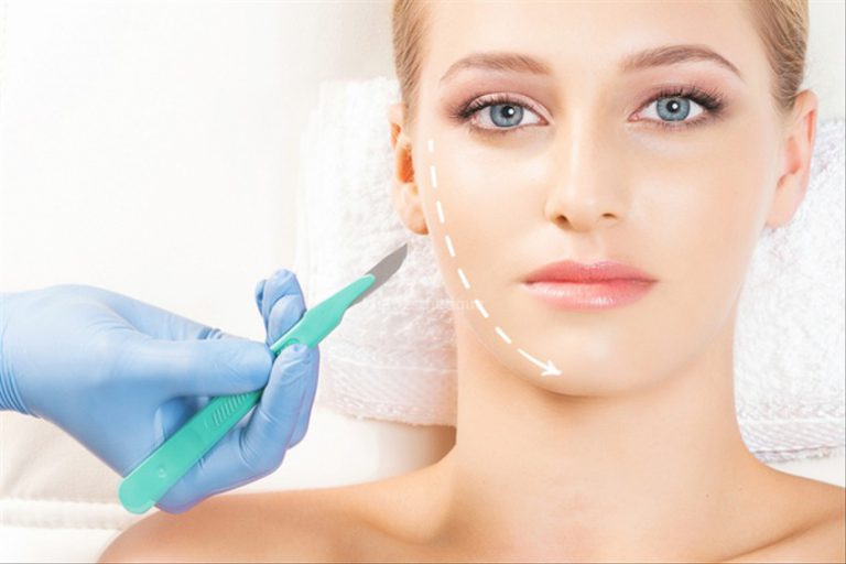 Bichectomie (Reducerea Bulei lui Bichat) | BeautyConcept